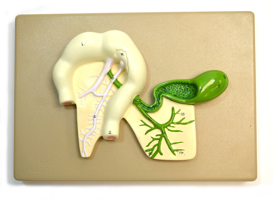 Human Pancreatic Duct Model - Mounted on Base, 10" x 7" - Eisco Labs ...