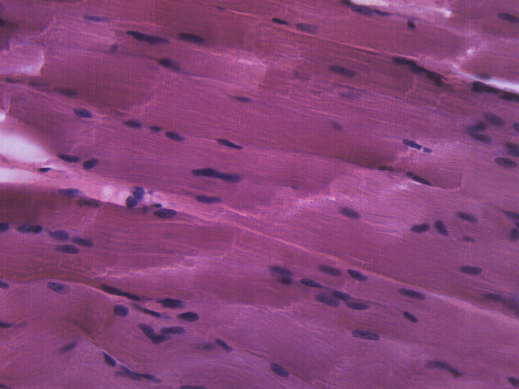 Skeletal Muscle Slides