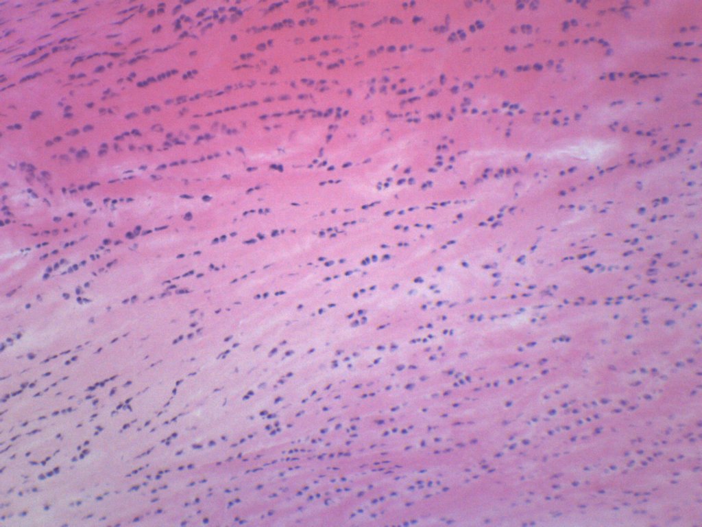 Fibrocartilage Histology