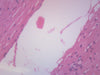 Human Artery & Vein - Prepared Microscope Slide — hBARSCI