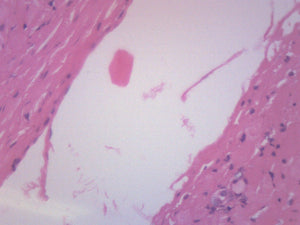 Human Artery & Vein - Prepared Microscope Slide — hBARSCI