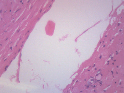Human Artery & Vein - Prepared Microscope Slide — hBARSCI