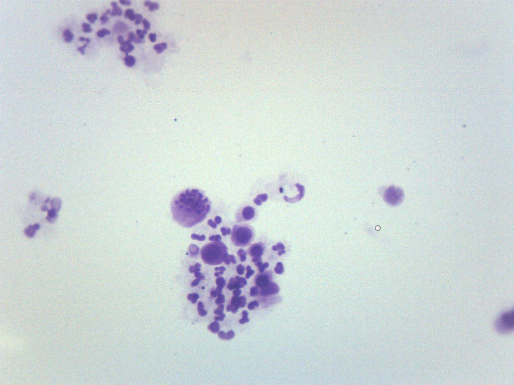 Trichomonas Slide