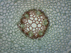 Ranunculus Young & Mature Root - Cross Section - Prepared Microscope S ...