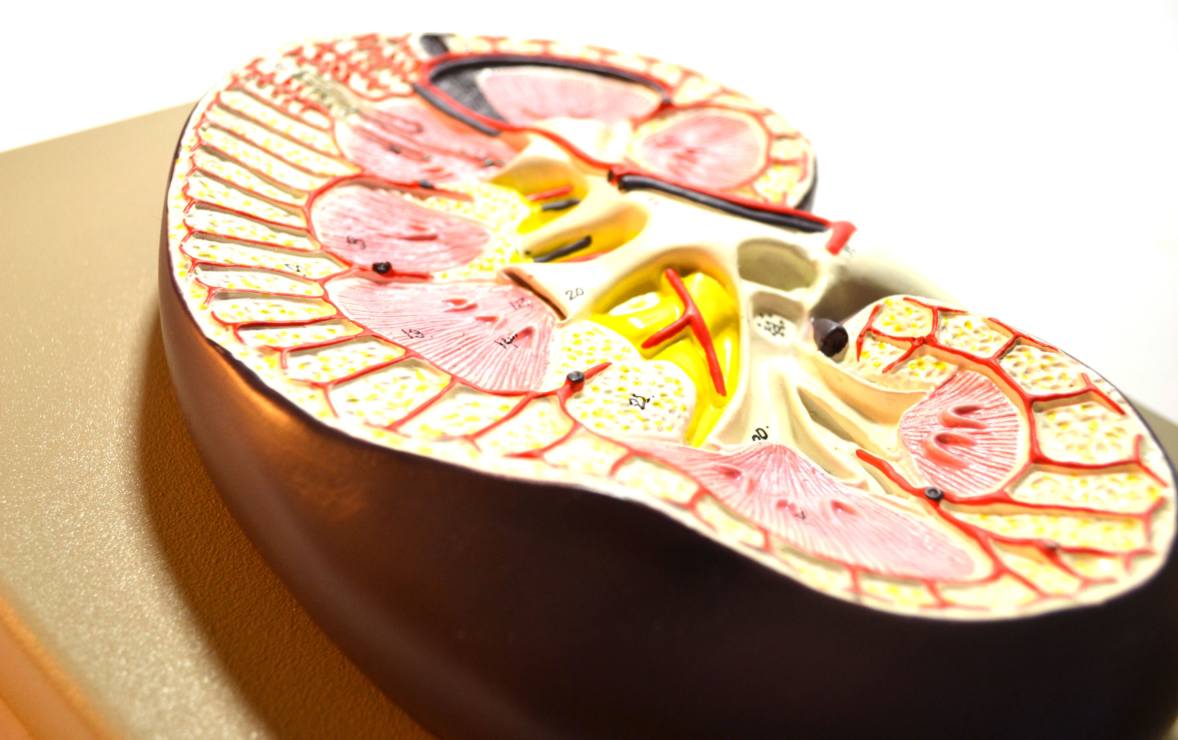 Model, Human, Kidney Section 3X Life Size — hBARSCI